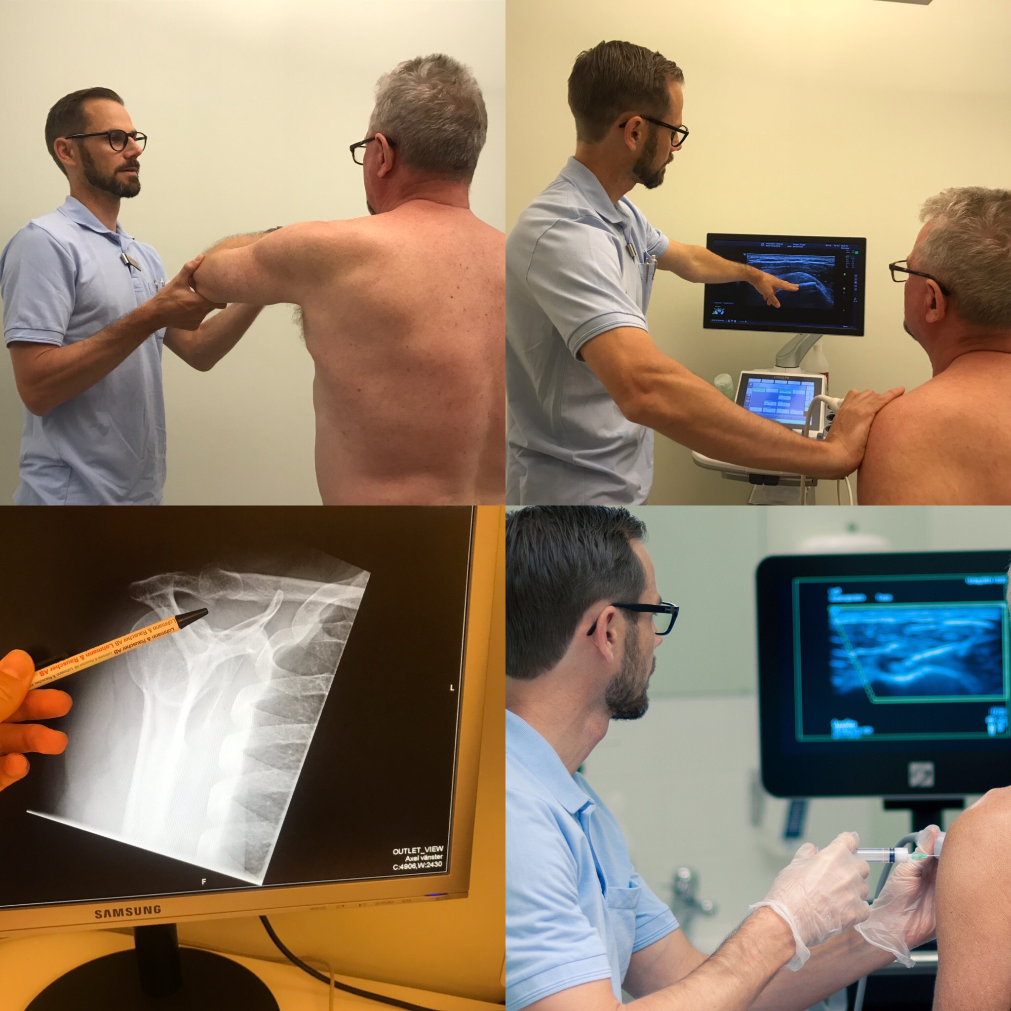 Shoulder Rehab Sweden