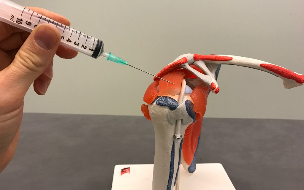 Shoulder Rehab Sweden