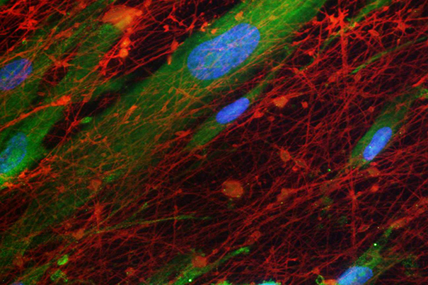 Matrix Biology Ireland - MBI