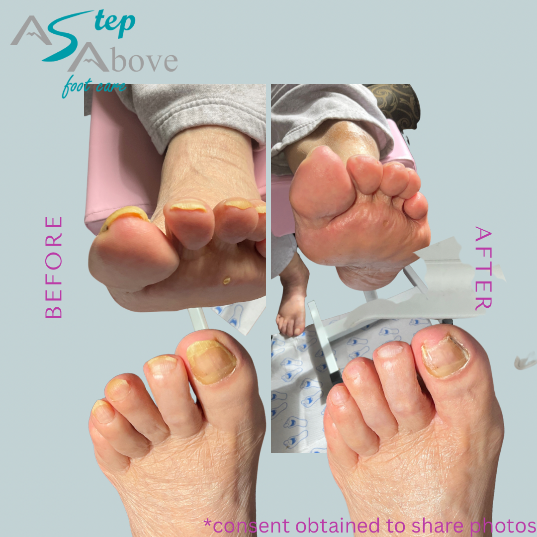 A Step Above